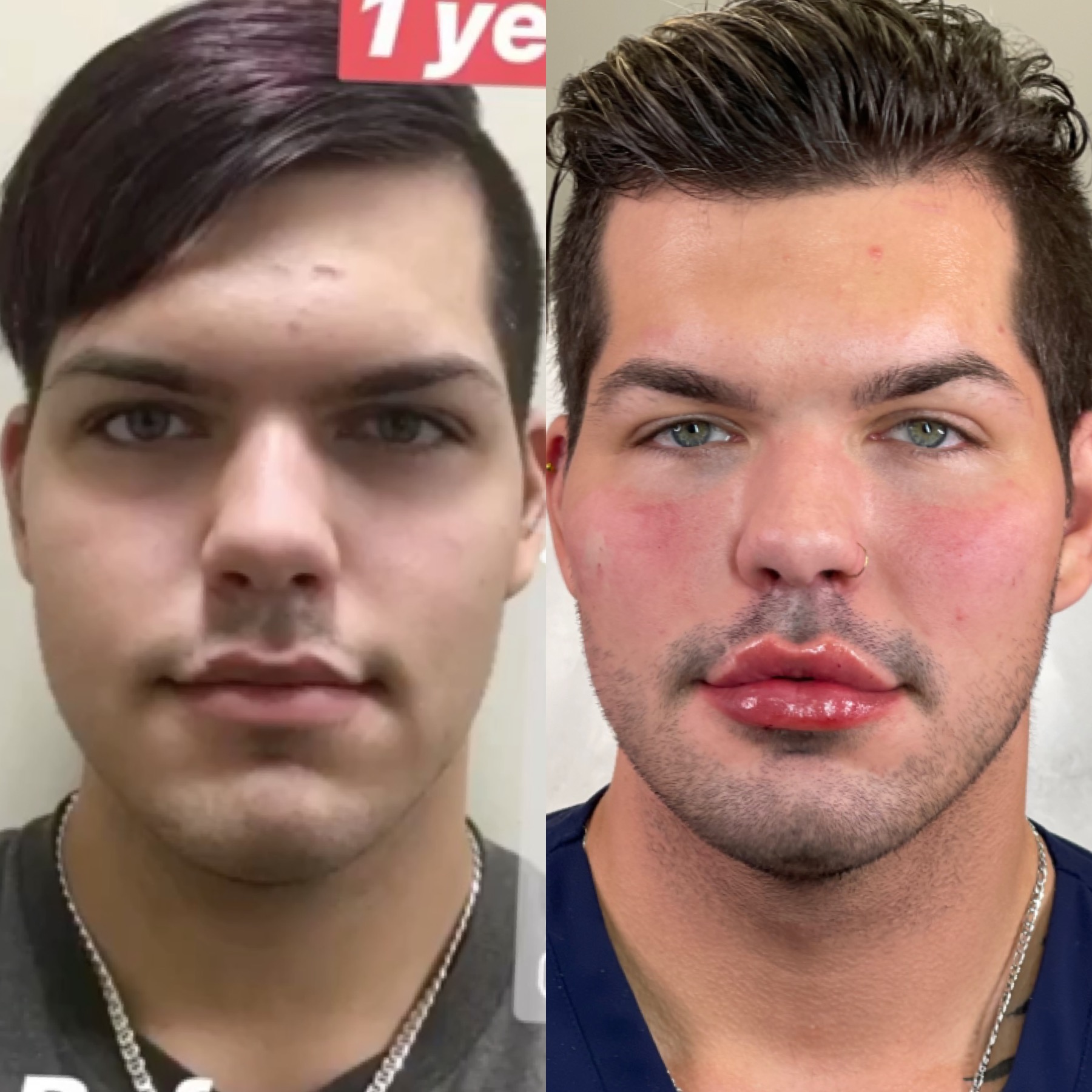 Facial Balancing | Lux Injectable